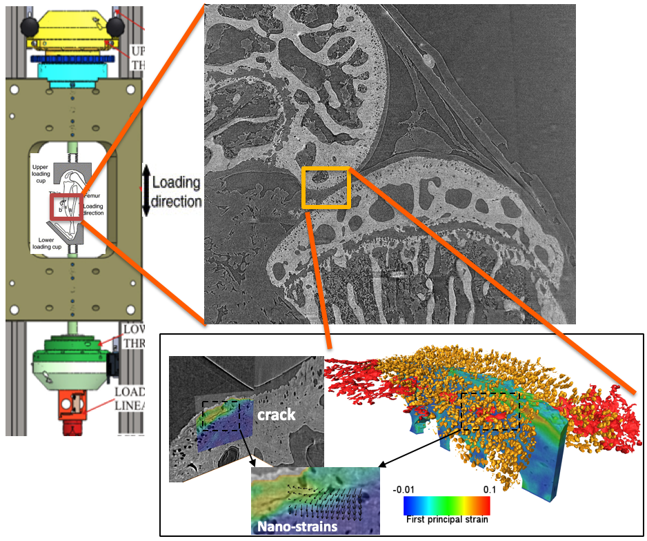 Improved X-ray based technique developed for understanding joint ...