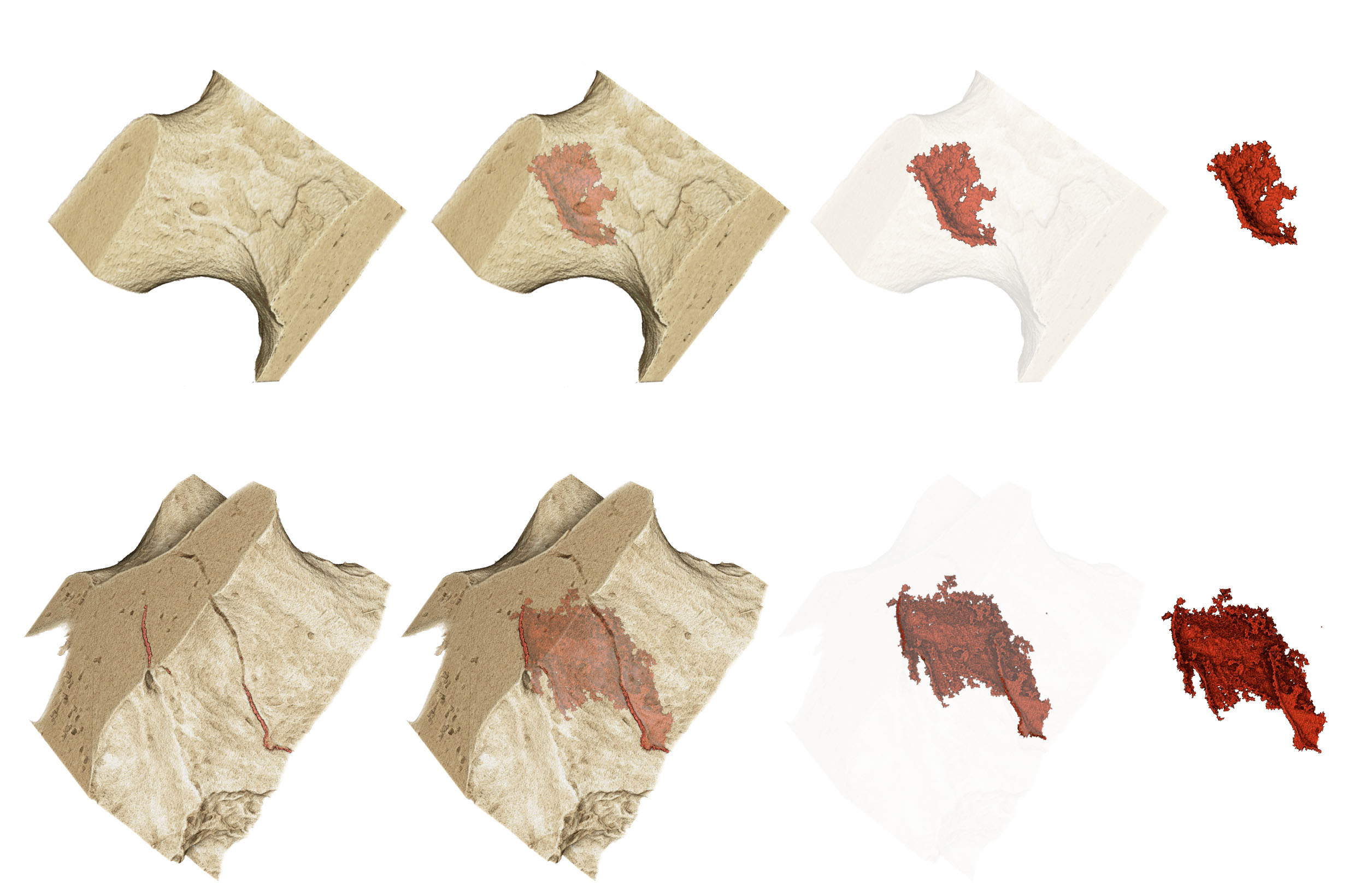 Diamond images Microcracks in bone - - Diamond Light Source